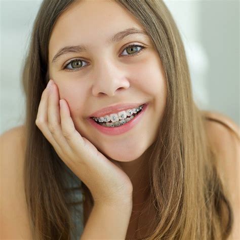 Self Ligating Braces Milford Ma Orthodontist Simply Orthodontics