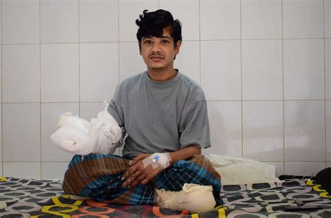 Hope For Bangladesh ‘tree Man After 16 Surgeries To Remove Growths