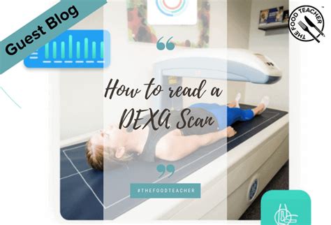 How To Read A Dexa Scan The Food Teacherthe Food Teacher