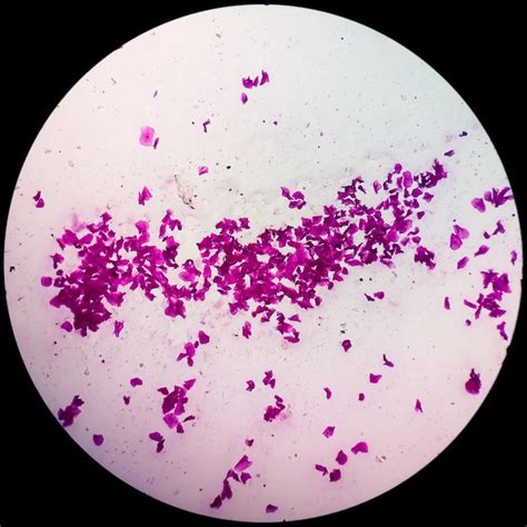 Premium Photo Microscopic View Of High Vaginal Swab Gram Stain Smear