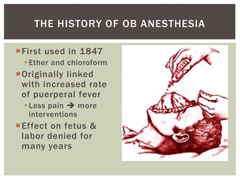 Ppt Obstetric Anesthesia Powerpoint Presentation Free Download Id