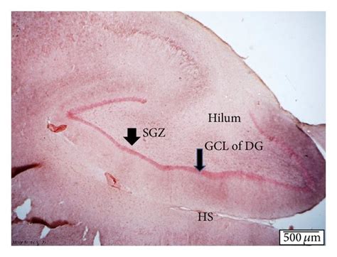 Doublecortin Staining Of Neurogenesis In The Dentate Gyrus Of The