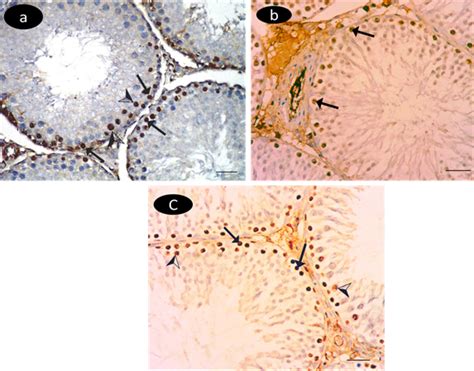 Cerium Oxide Nanoparticles Protect Against Oxaliplatin Induced