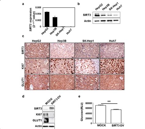 Expression Of Sirt3 In Hepatocellular Carcinoma Hcc Cell Lines And