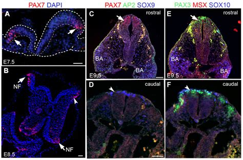 Spatiotemporal Expression Of Neural Crest Markers Including Pax7 In