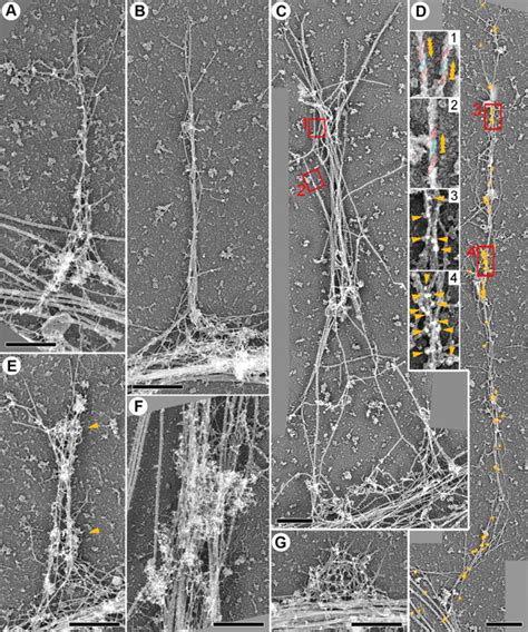 Molecular Architecture Of Synaptic Actin Cytoskeleton In Hippocampal