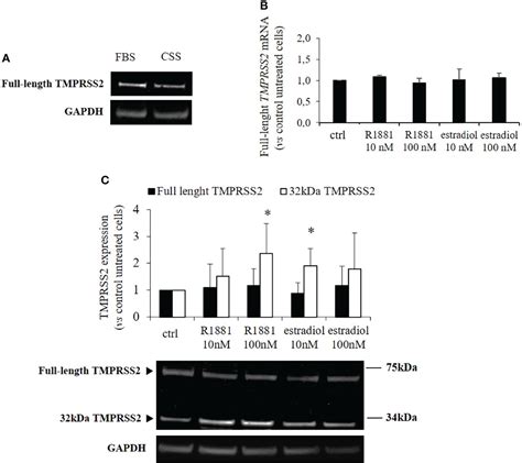 Frontiers Tmprss2 Expression And Activity Modulation By Sex Related