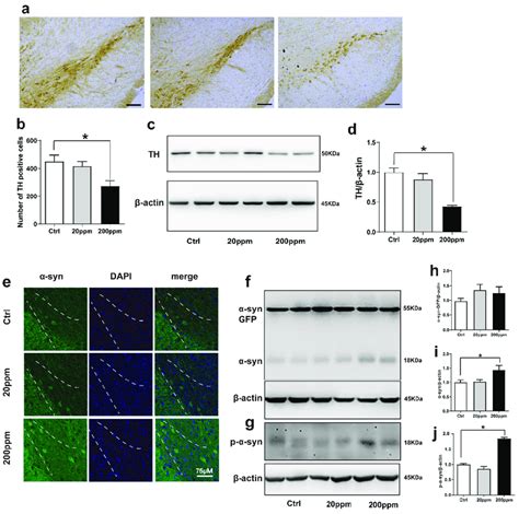 Zn 2 Aggravates The Pathology Of α Synuclein Gfp Transgenic Mice Zn