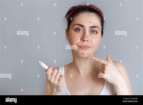 La Puberté Banque De Photographies Et Dimages à Haute Résolution Alamy