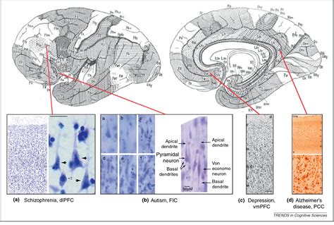Figure 3 From Large Scale Brain Networks And Psychopathology A