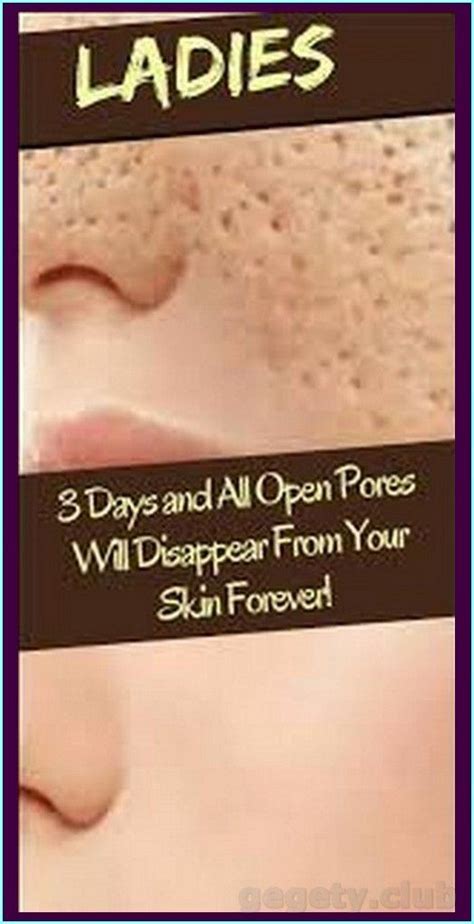 3 Days And All Open Pores Will Disappear From Your Skin Permanently