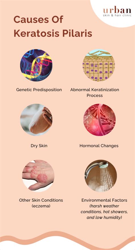 Keratosis Pilaris Causes Symptoms And Treatment Ushc