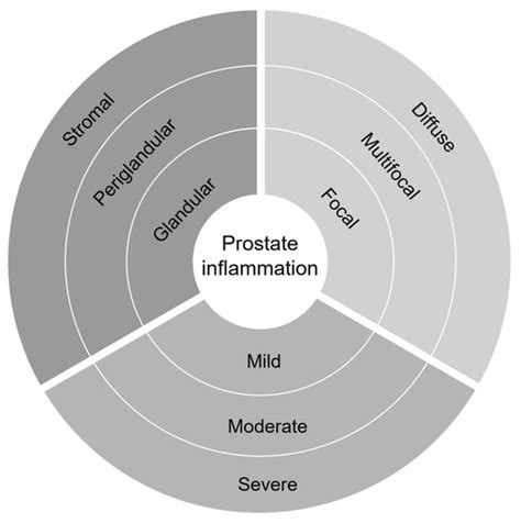 Cancers Free Full Text Inflammation And Prostate Cancer A