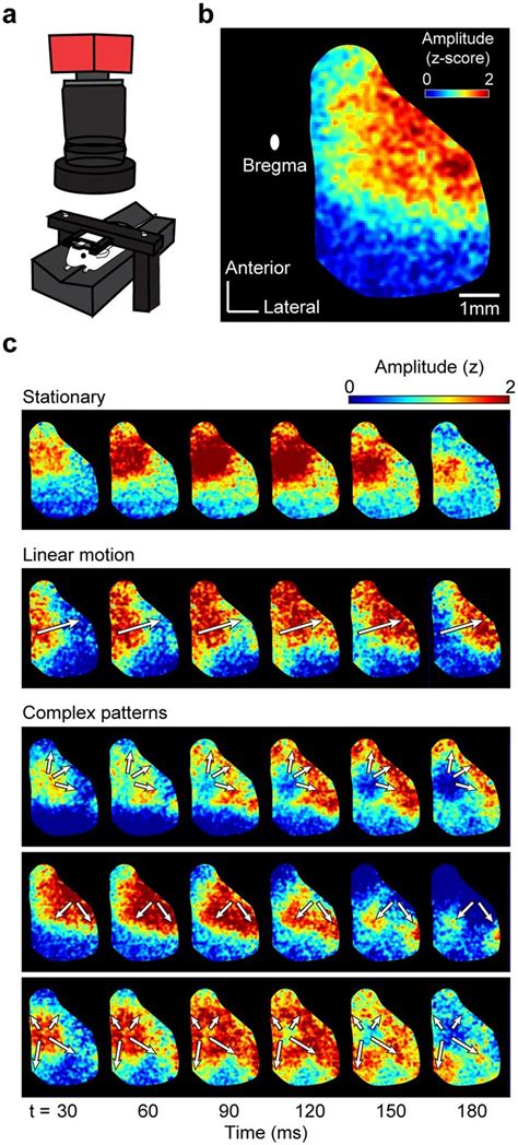 Various Spatiotemporal Patterns Observed In Voltage Sensitive Dye