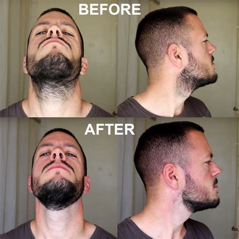 Aberlite Flexshaper Beard Neckline Guide Aberlite