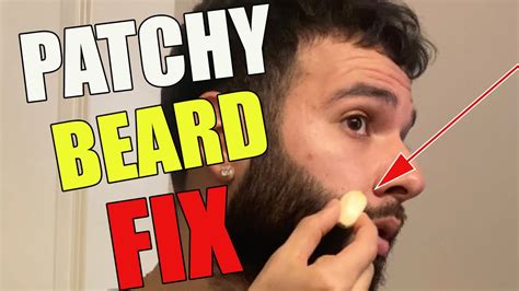 The Secret To Curing A Patchy Beard The Untold Remedy Youtube