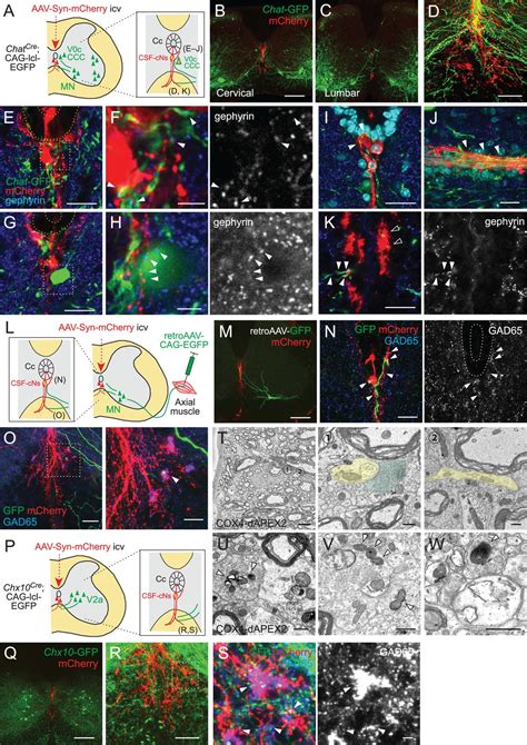 Figures And Data In Cerebrospinal Fluid Contacting Neuron Tracing