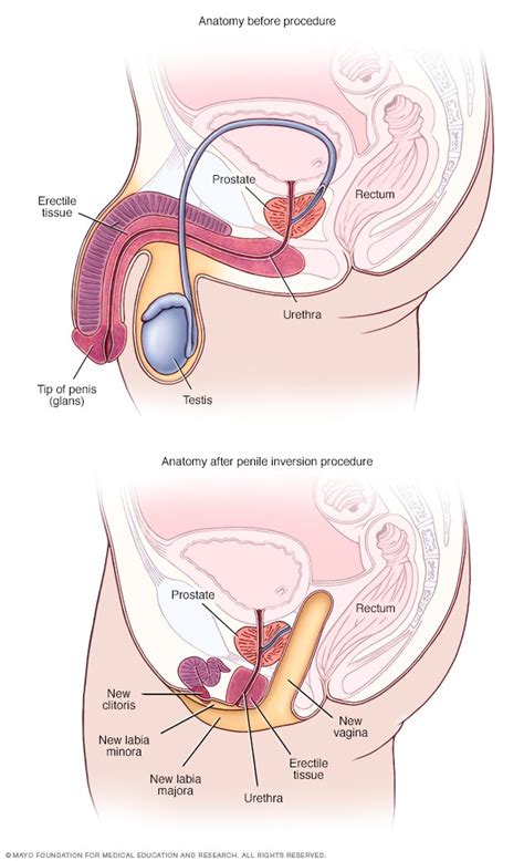 anatomy before and after penile inversion mayo clinic