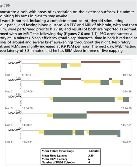 five napping opportunities from multiple sleep latency test mslt are