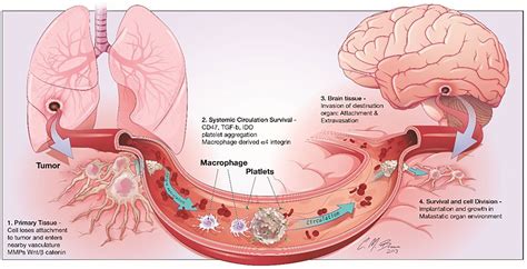 Frontiers The Immune Microenvironment In Brain Metastases Of Non