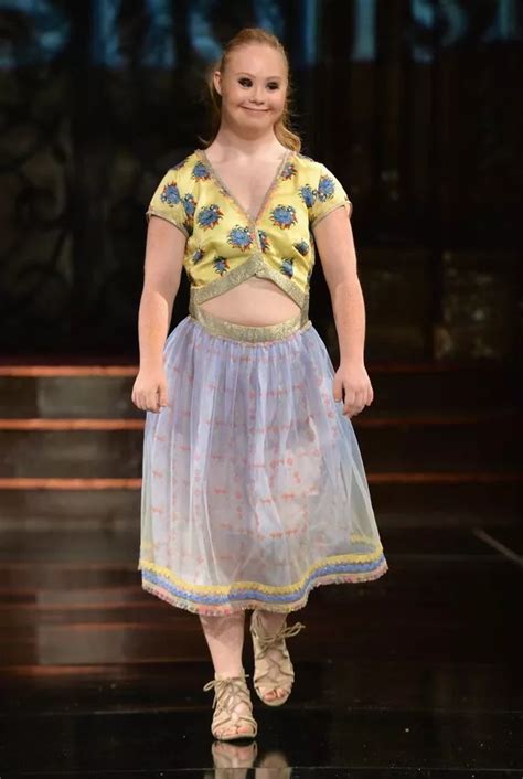 Supermodel With Downs Syndrome Is Flanked By The Stars As She Returns