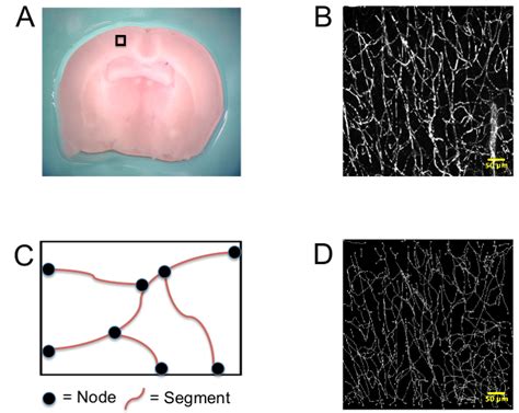 quantification of cerebral vascular architecture using two photon