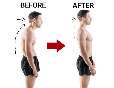 How To Permanently Fix Your Posture Pin Posture Benefit Fix Bad