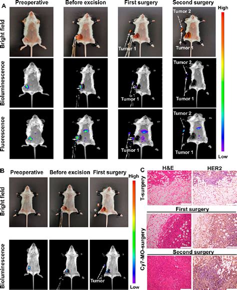 Surgical Resection Of Orthotopic Breast Tumors A Detection And