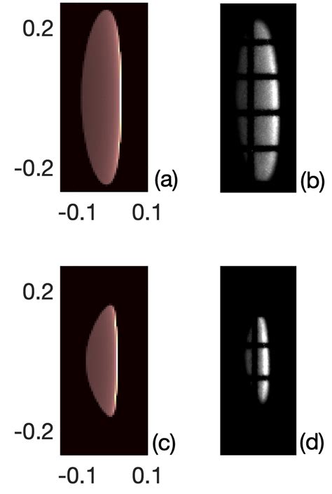 Comparison Of Computed Ray Densities A And C Whose Axial Location