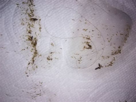 Live Lice Eggs