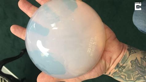 Joey Prixx Bum Implants Man Spends Thousands To Get The Perfect Butt