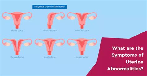 Understanding The Symptoms Of Uterine Abnormalities Nova Ivf Fertility