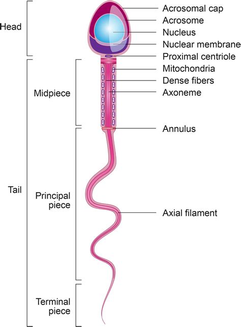 Spermatocele Diagram