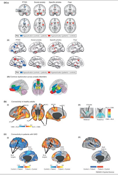 [pdf] Large Scale Brain Networks And Psychopathology A Unifying Triple