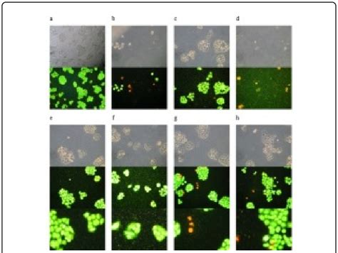 Phase And Fluorescent Micrographs Of Acridine Orange And Propidium