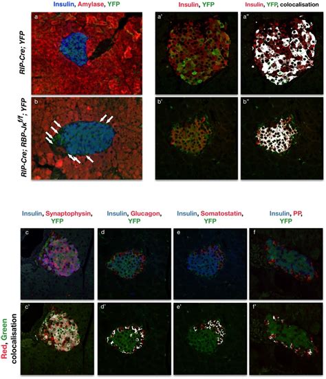 Lineage Tracing Of Rbp Jκ Deficient β Cells Immunostaining For Insulin