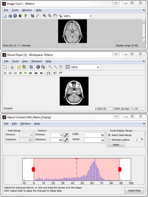 6 image display and analysis