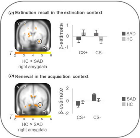 Stronger Neural Activation For Differential Conditioned Responding