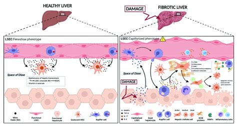 Progression Of Hepatic Fibrosis Download Scientific Diagram