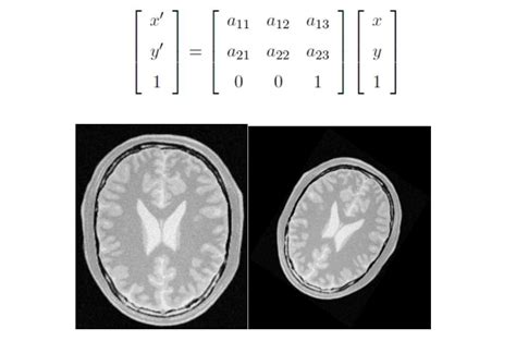 opencv calculate the affine transformation matrix in image feature
