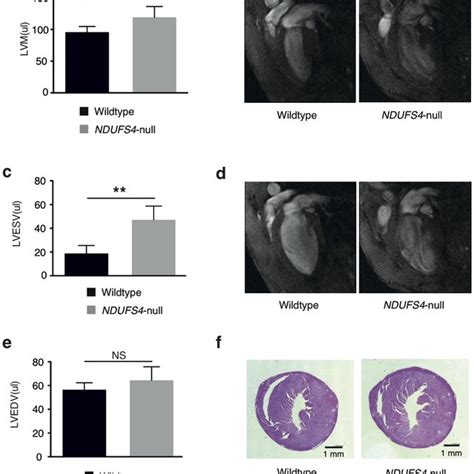a left ventricular ejection fraction lvef of control