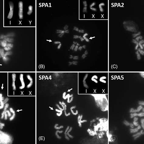 Karyotypes Of Samples From Each Investigated Housefly Strain Sex
