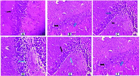 Histopathology Of Rat Brain Hippocampus Section With Hande ×400 A