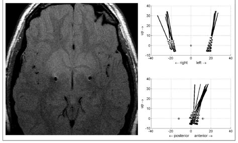 Representative Postoperative Magnetic Resonance Imaging Proton