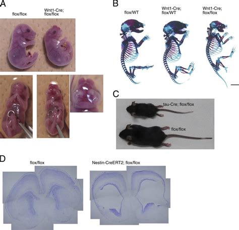 Phenotypes Of Cell Specific Deletion Of Smc3 A An E17 5 Wnt1 Cre