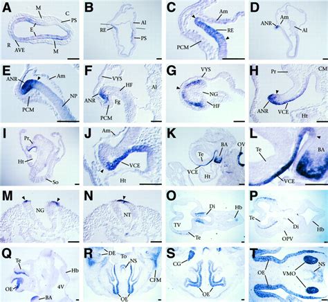 An Early Phase Of Embryonic Dlx5 Expression Defines The Rostral