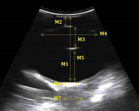 Scielo Brasil Biometric B Mode And Color Doppler Ultrasound