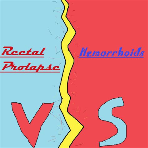 Rectal Prolapse Vs Hemorrhoids Goddessless
