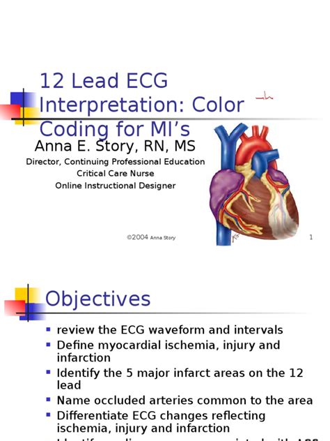 12 lead ecg color codes 1 04 1 electrocardiography cardiology