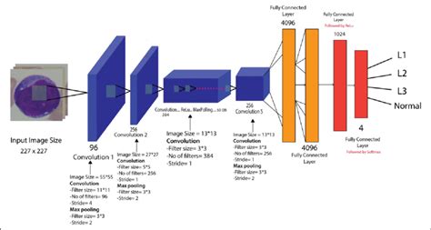 alexnet architecture for acute lymphoblastic leukemia subtype